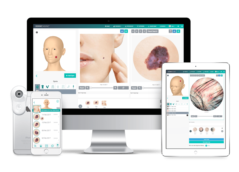 Dermengine Dermatology Made Intelligent 7260